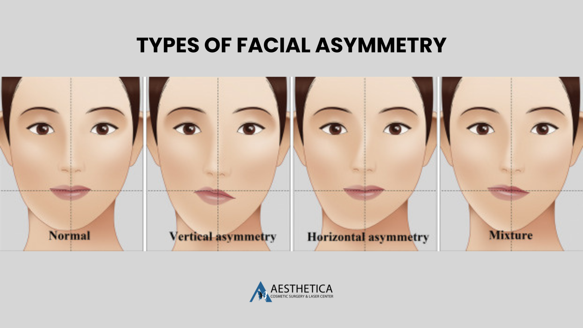 How to Combat Facial Asymmetry
