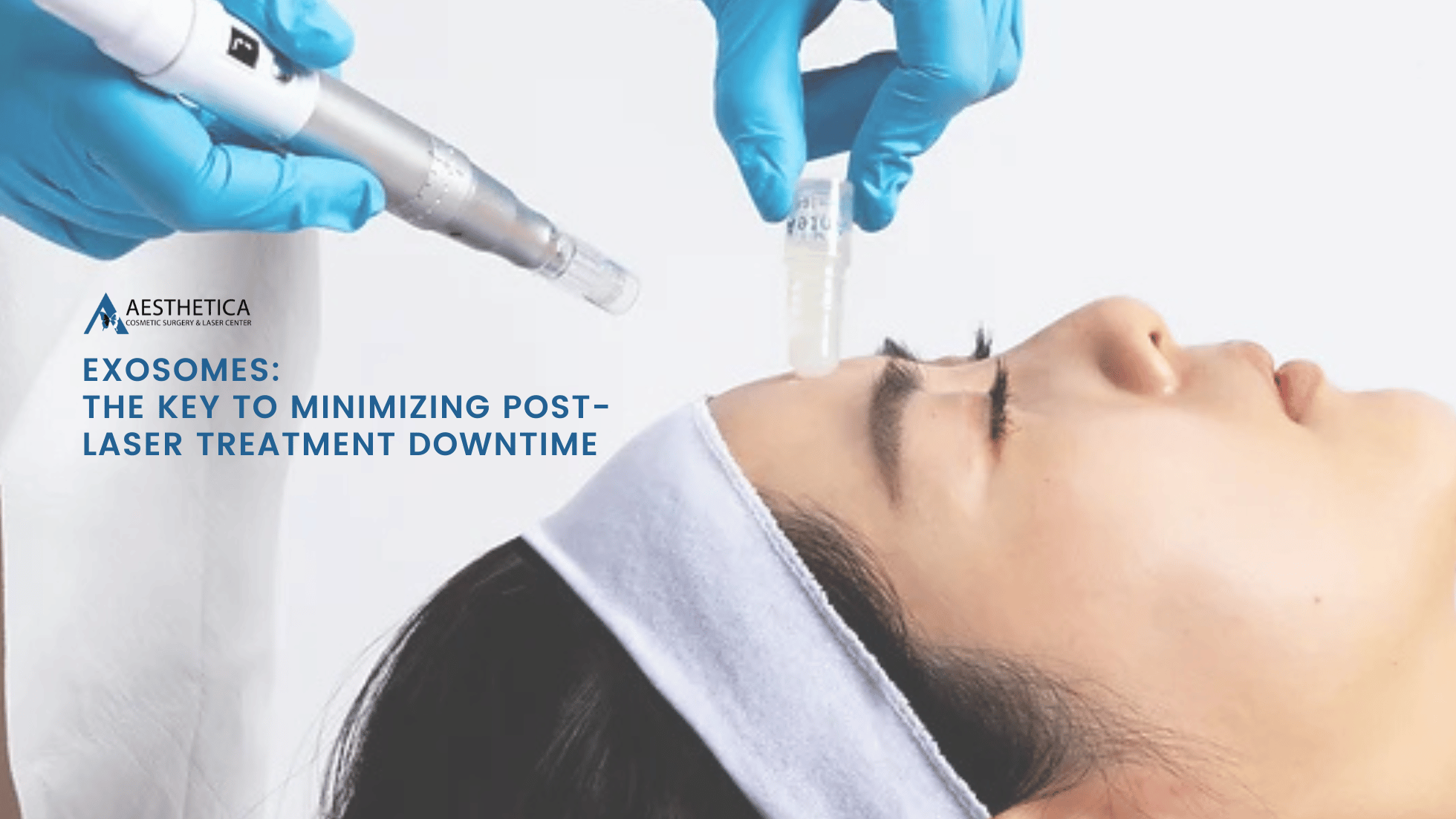 Exosomes for Minimizing Post-Laser Treatment Downtime